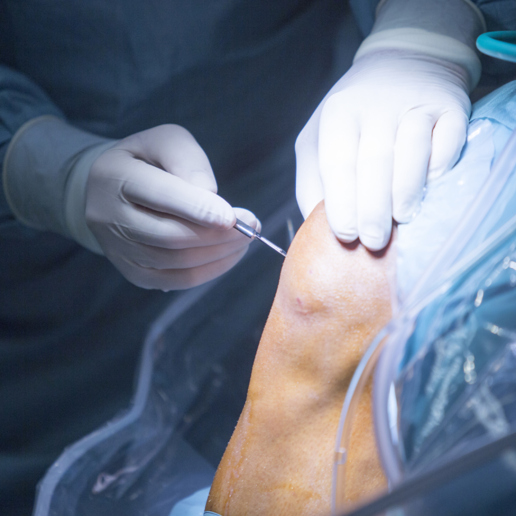 Best orthopaedic doctor near me in Mumbai - Dr.Nihit Gadodia
